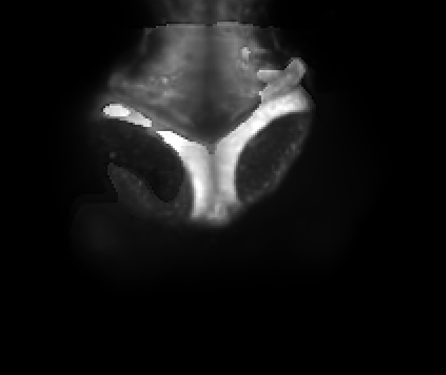 Advanced Normalization Tools ( ANTs ) / Discussion / Help: Basic multimodal template ...
