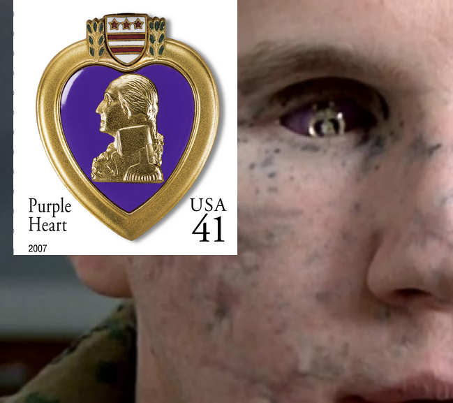 Medal Of Honor recipient Kyle Carpenter before and after facial ...
