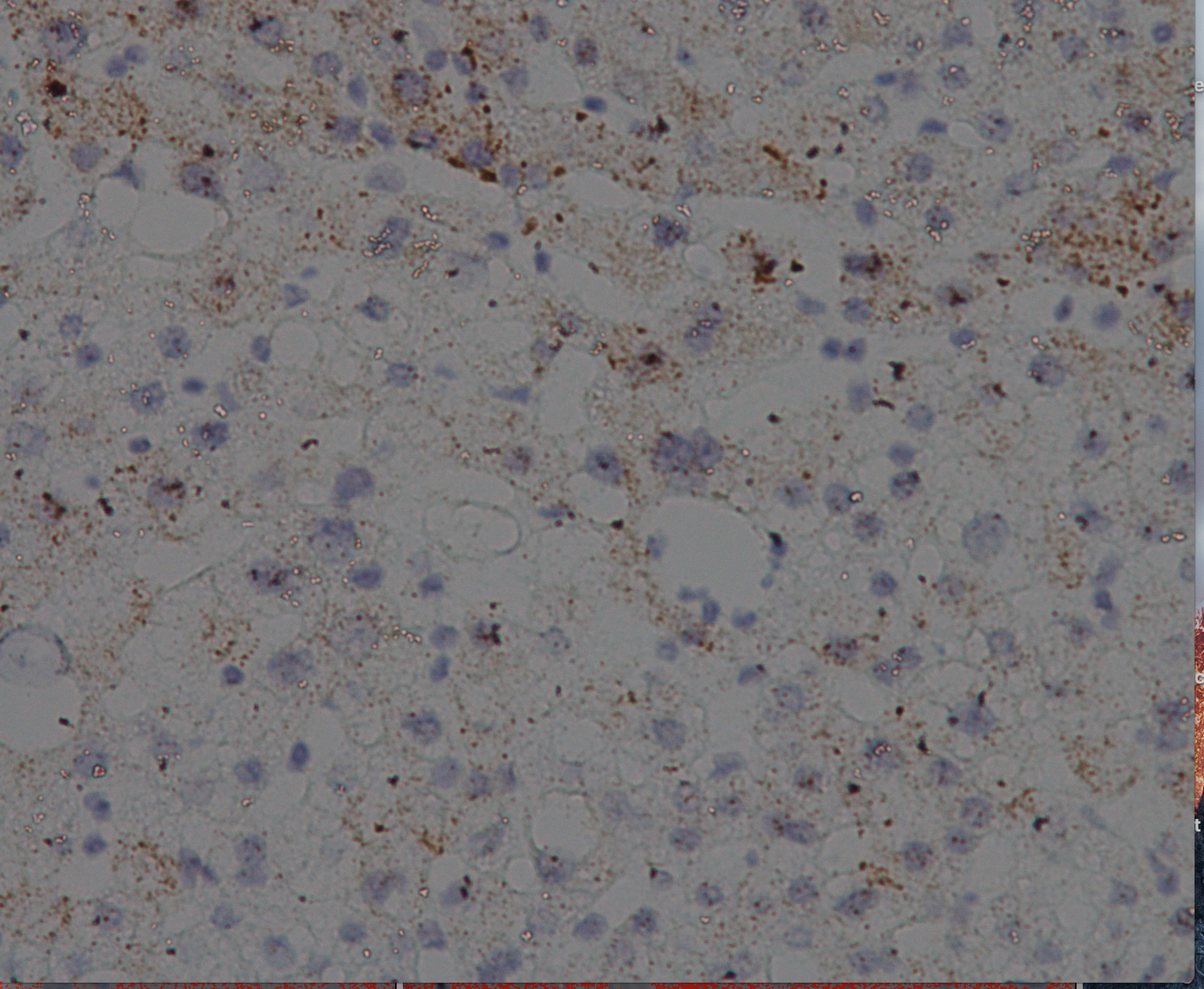 IHC quantification - RNAScope Brown Protocol - Image Analysis - Image ...