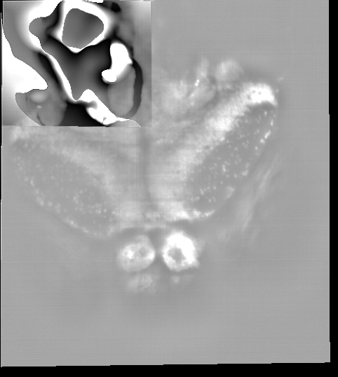 Advanced Normalization Tools ( ANTs ) / Discussion / Help: Basic multimodal template ...