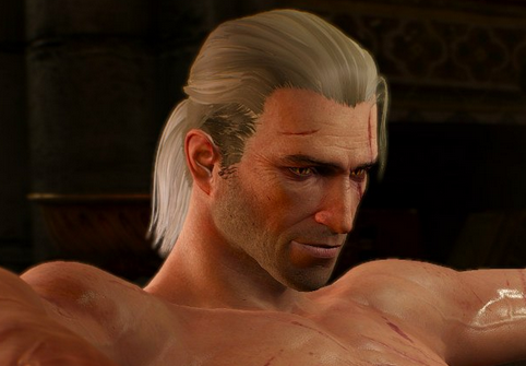 balding witcher bug|баг с волосами - лысеющий ведьмак :: The Witcher 3 ...