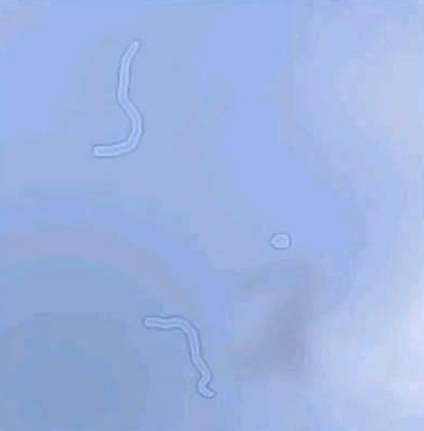 ELI5: What are these specs/worms that people have in their vision? (PIC ...