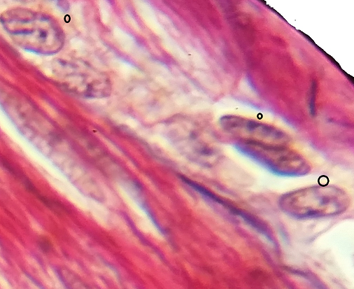 Need help identifying the circular(-ish) objects in this micrograph of ...