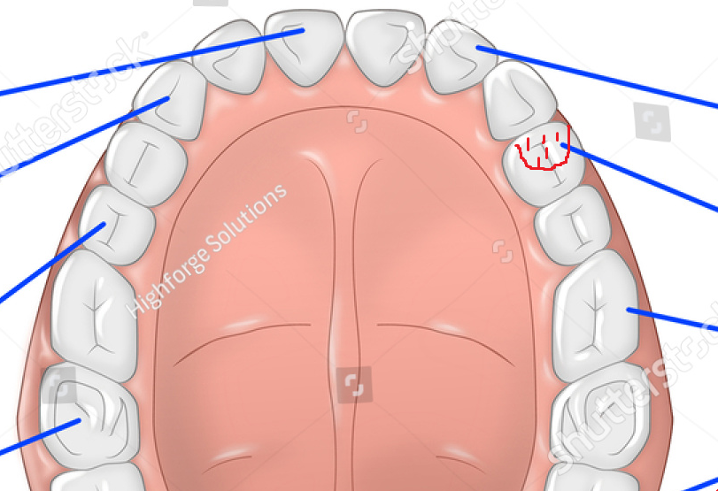 A part of my tooth fell off. : r/Dentistry