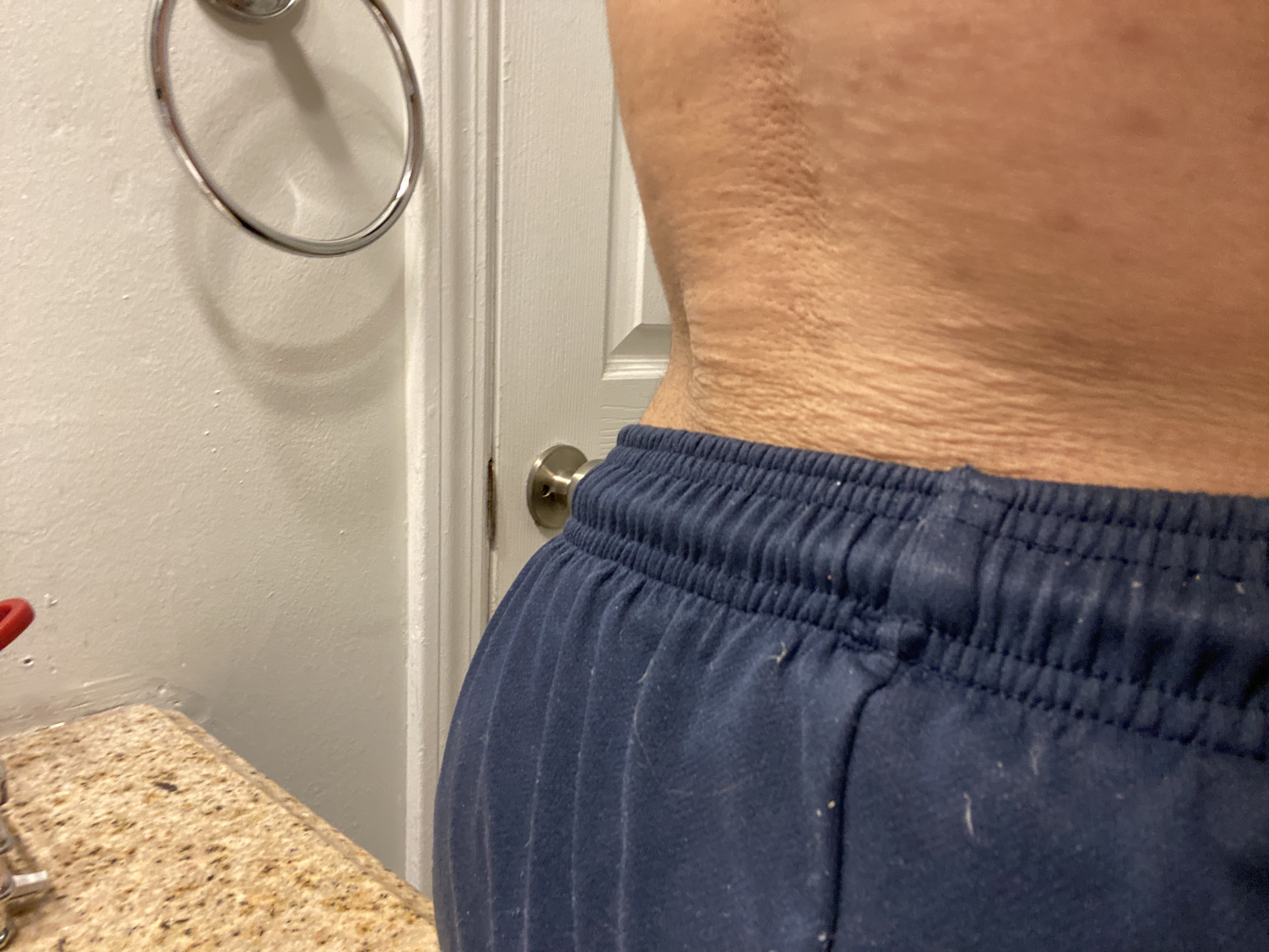 [Skin concerns] wrinkles on lower back please help I’m only 18 and I’m ...