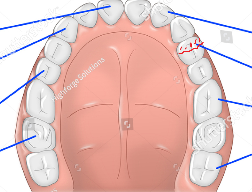 A part of my tooth fell off. : r/Dentistry